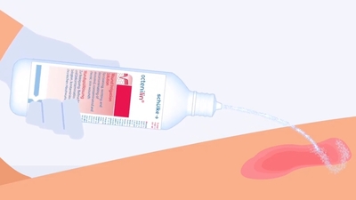 How to use octenilin® | schuelke UK